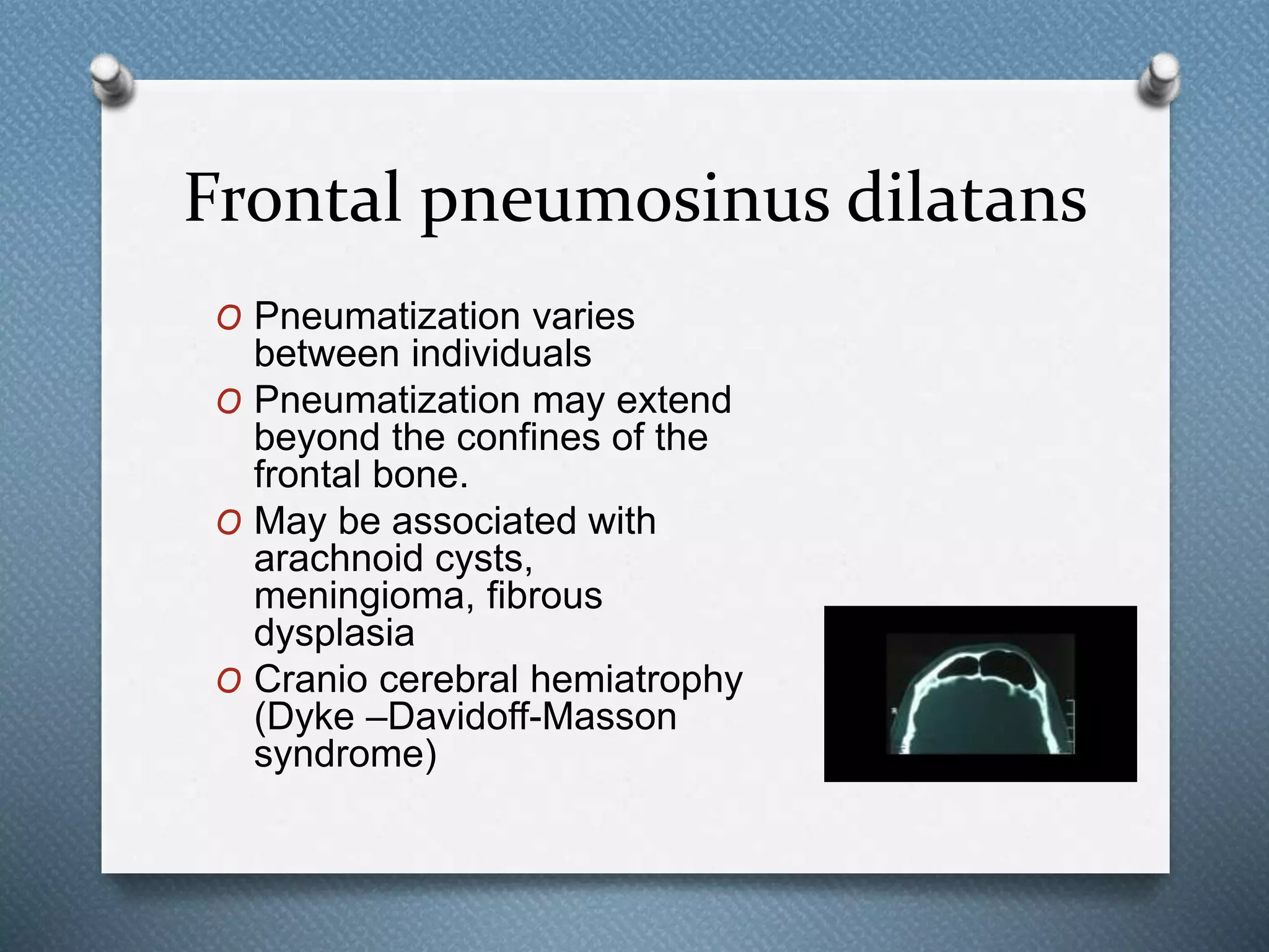 Frontal sinus procedures | PPTX