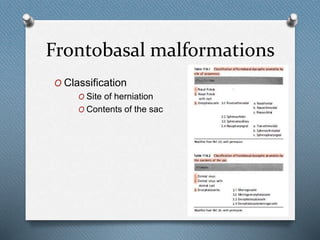 Frontal sinus procedures | PPTX