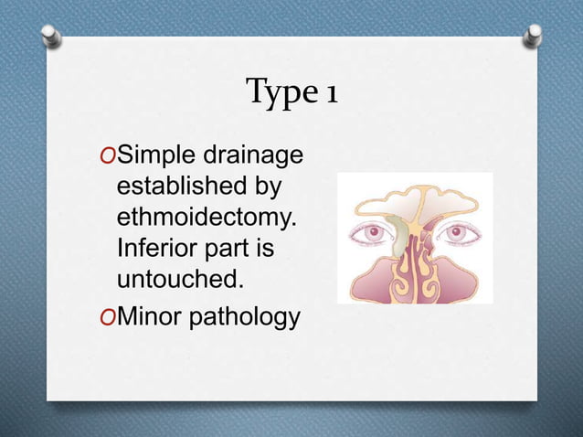 Frontal sinus procedures | PPTX