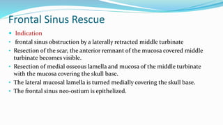 Frontal sinus surgical aproach | PPTX