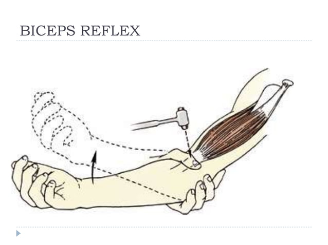 FRONT OF ARM.ppt | Death, Injury, or Military Conflict | Sensitive Topics