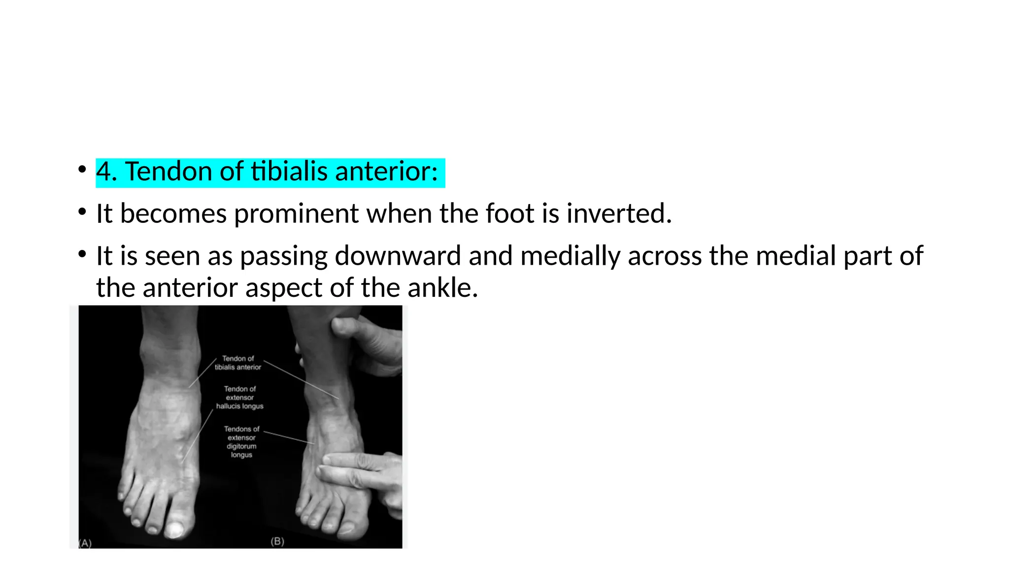 front of leg and dorsum of foot ll lecture.pptx