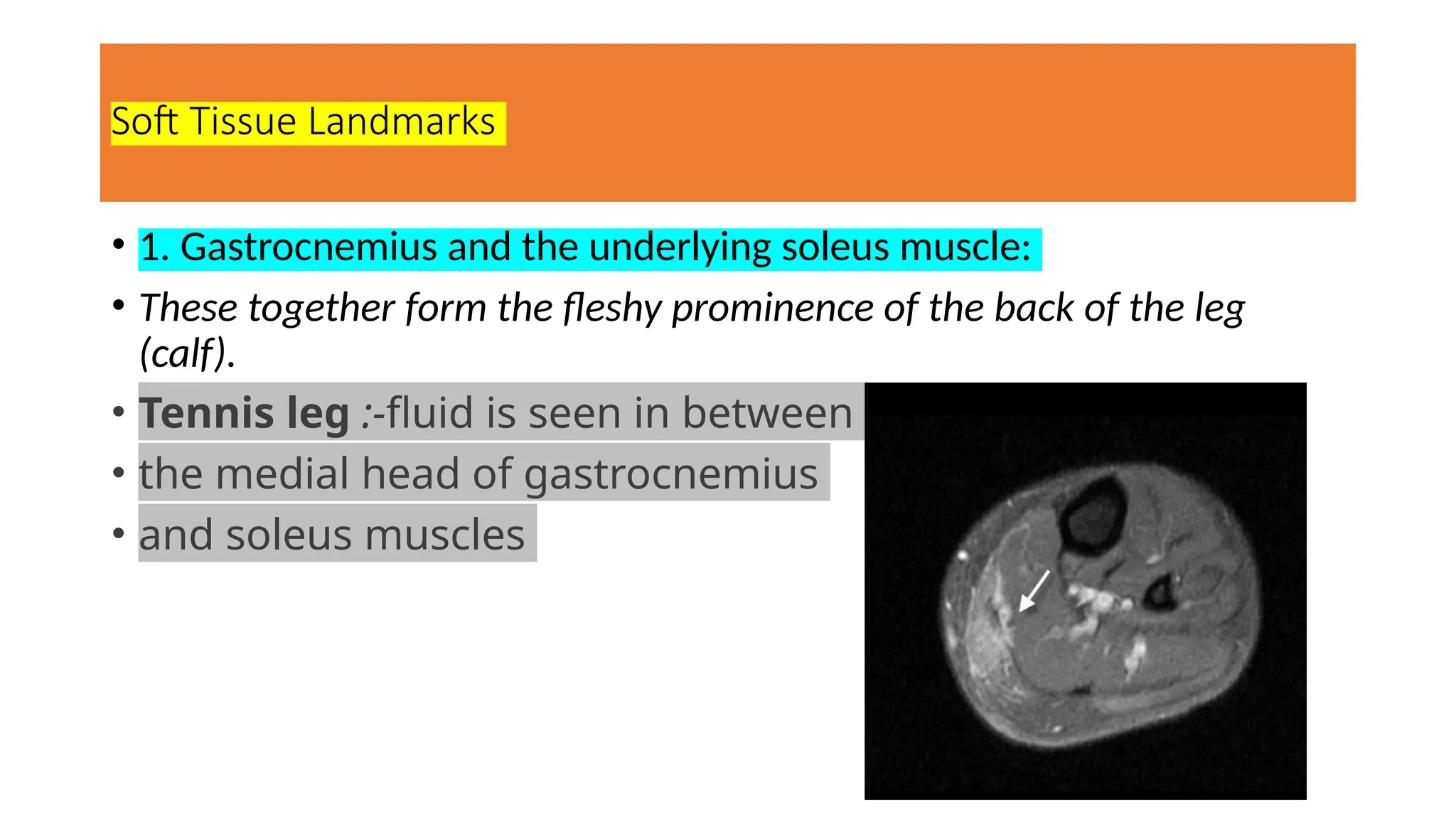 front of leg and dorsum of foot ll lecture.pptx