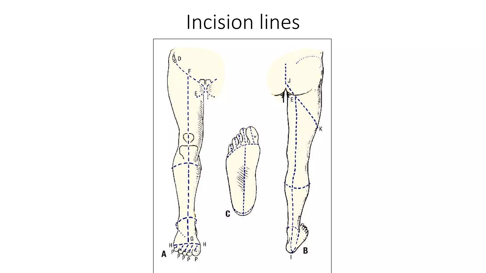 Front of thigh | PDF