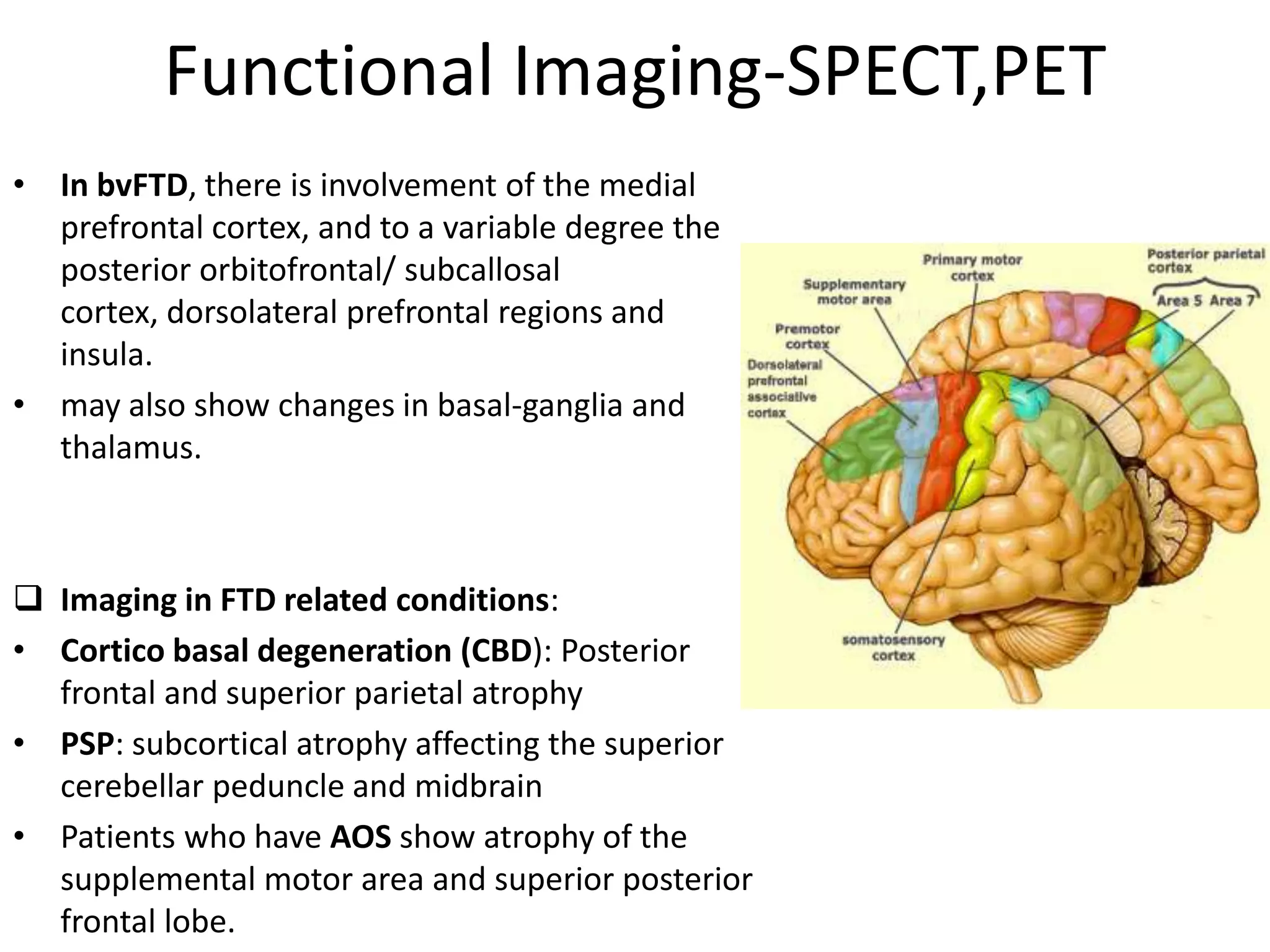 Frontotemporal dementia: Neural circuits, genetics and neuropathology ...
