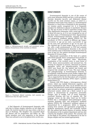 Original Research work on Frontotemporal Dementia by Prof Dr Bashir ...
