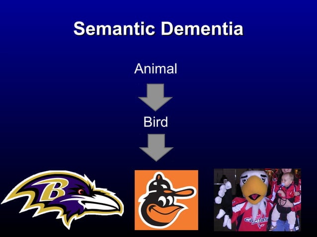 Frontotemporal Dementia: An Overview | PPT