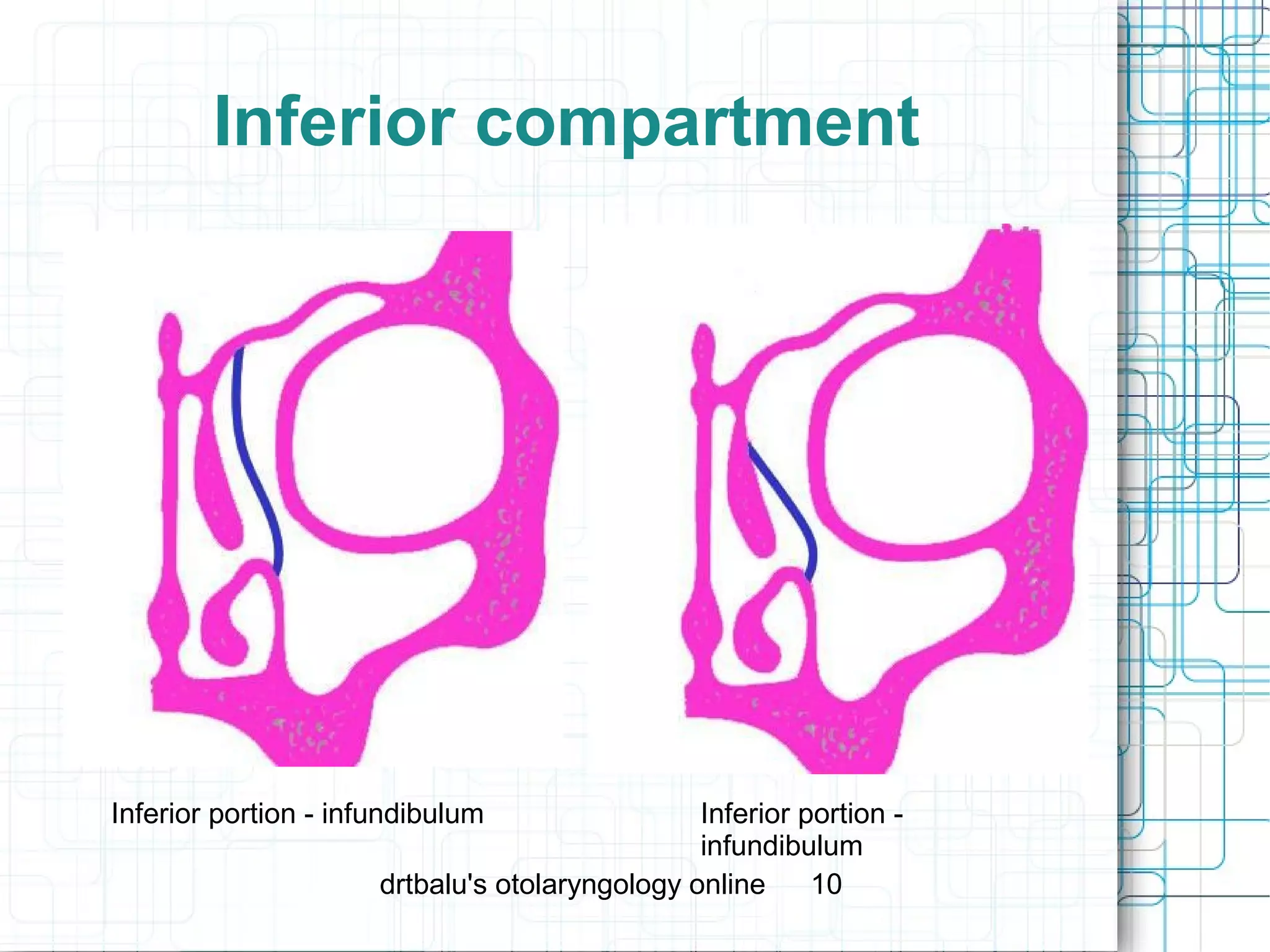 Radiological anatomy of frontal sinus | PPT