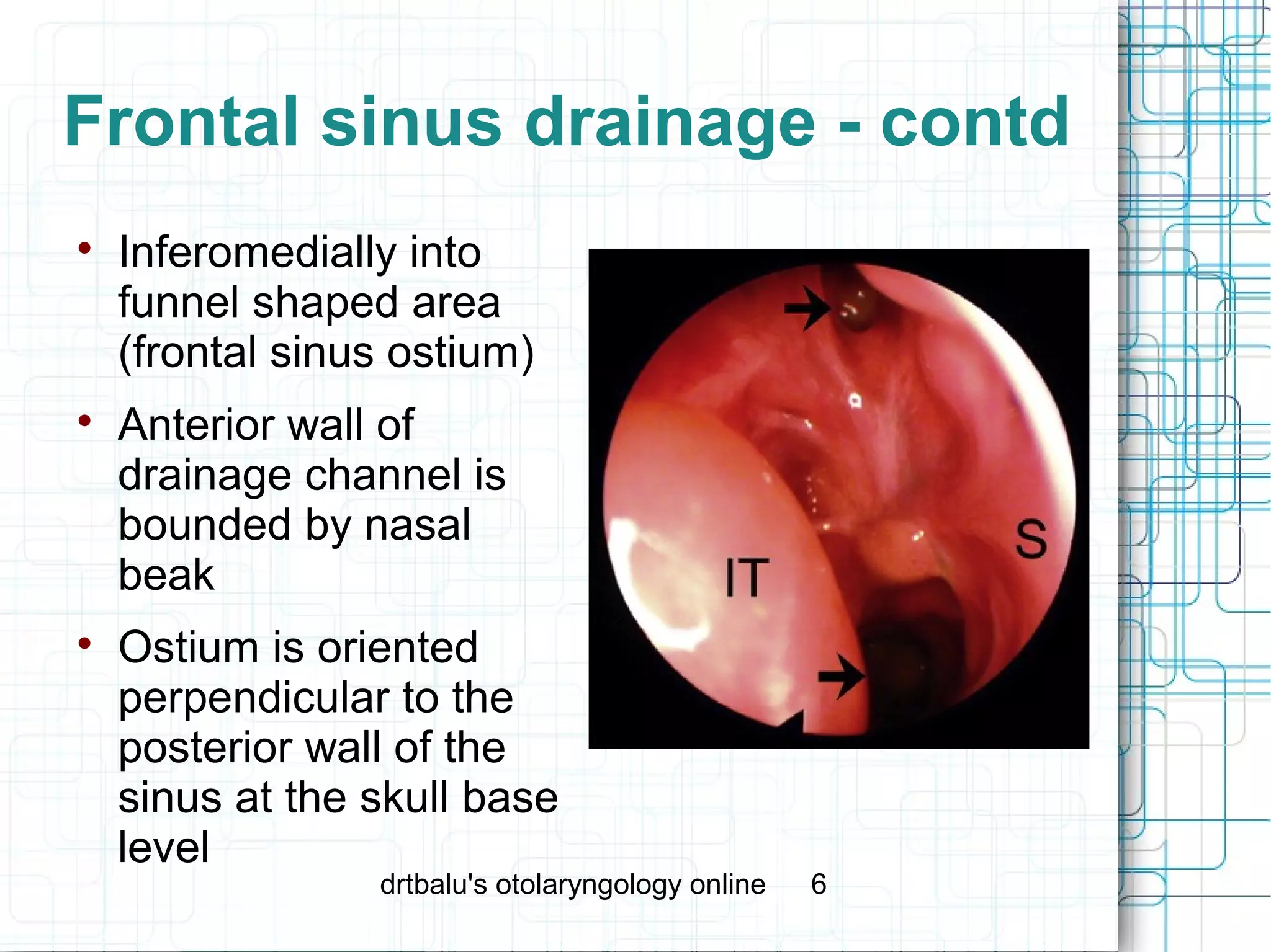 Radiological anatomy of frontal sinus | PPT