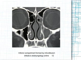 Radiological anatomy of frontal sinus | PPT