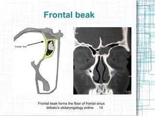 Radiological anatomy of frontal sinus | PPT