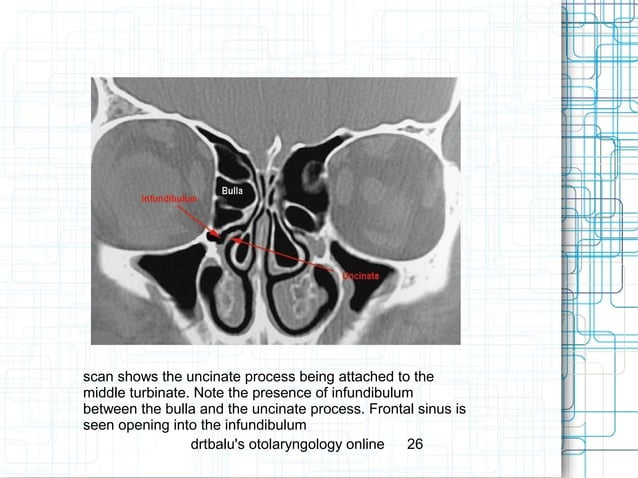 Radiological anatomy of frontal sinus