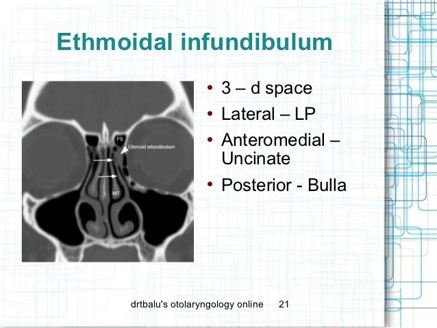 Radiological anatomy of frontal sinus