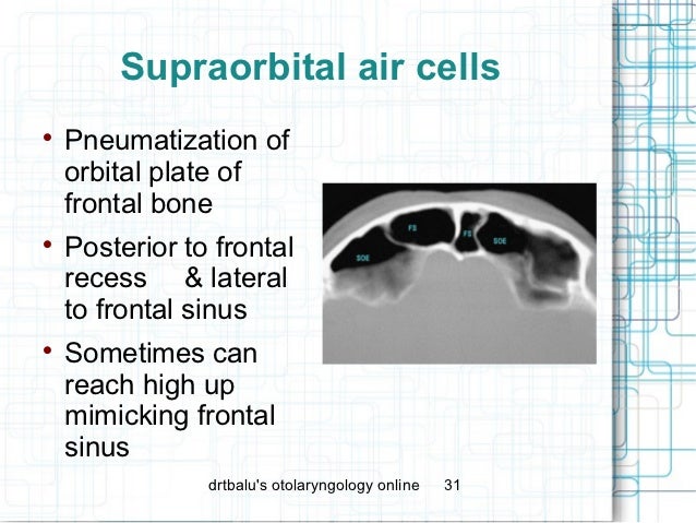 Radiological anatomy of frontal sinus