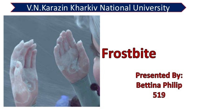 Frostbite | PPT