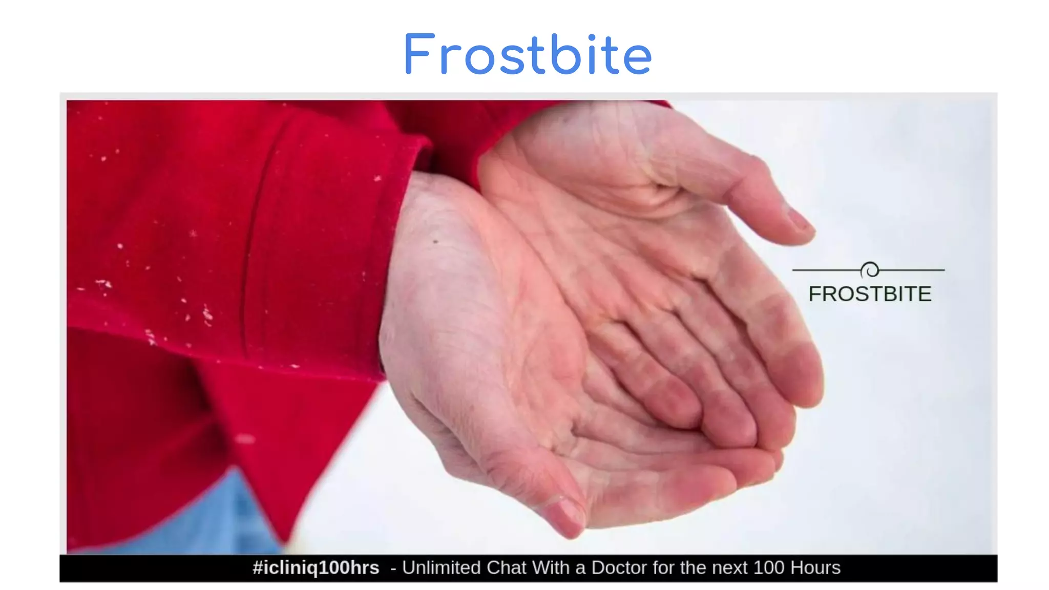 Frostbite | PDF