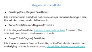 Frostbite | PDF