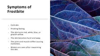 Frostbite.pptx