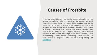 Frostbite.pptx