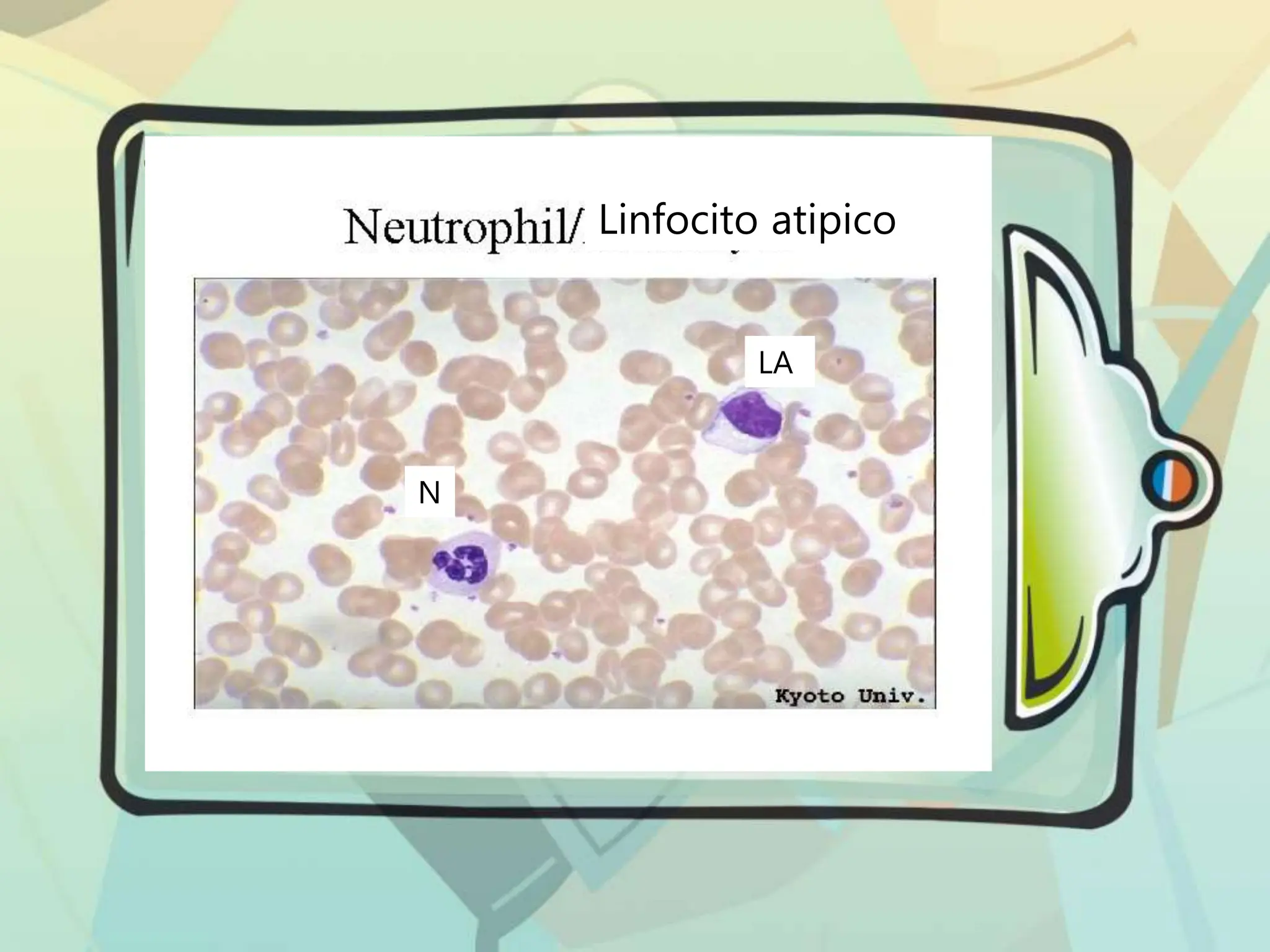Interpretation of the peripheral smear and CBC | PPT