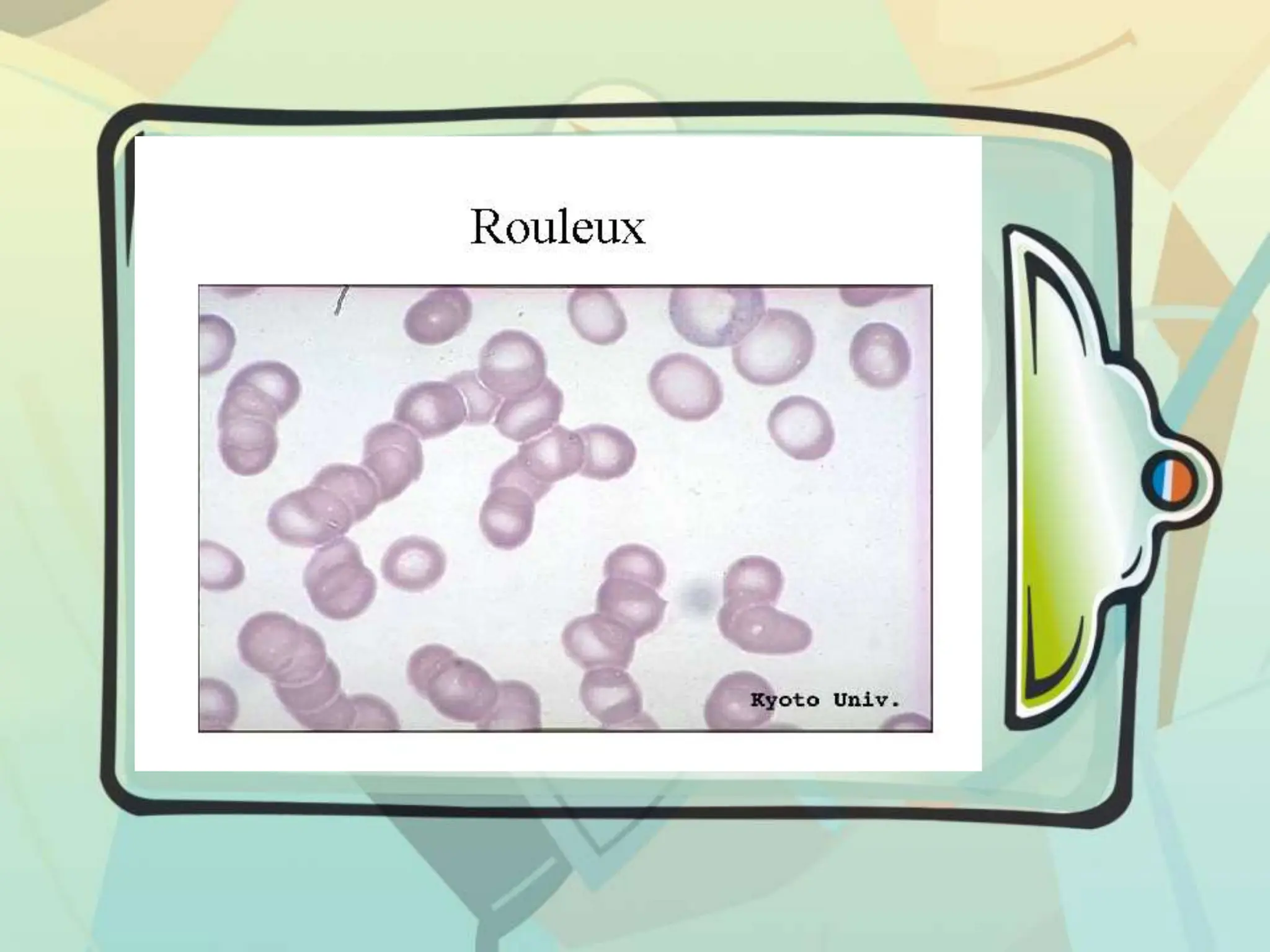 Interpretation of the peripheral smear and CBC | PPT