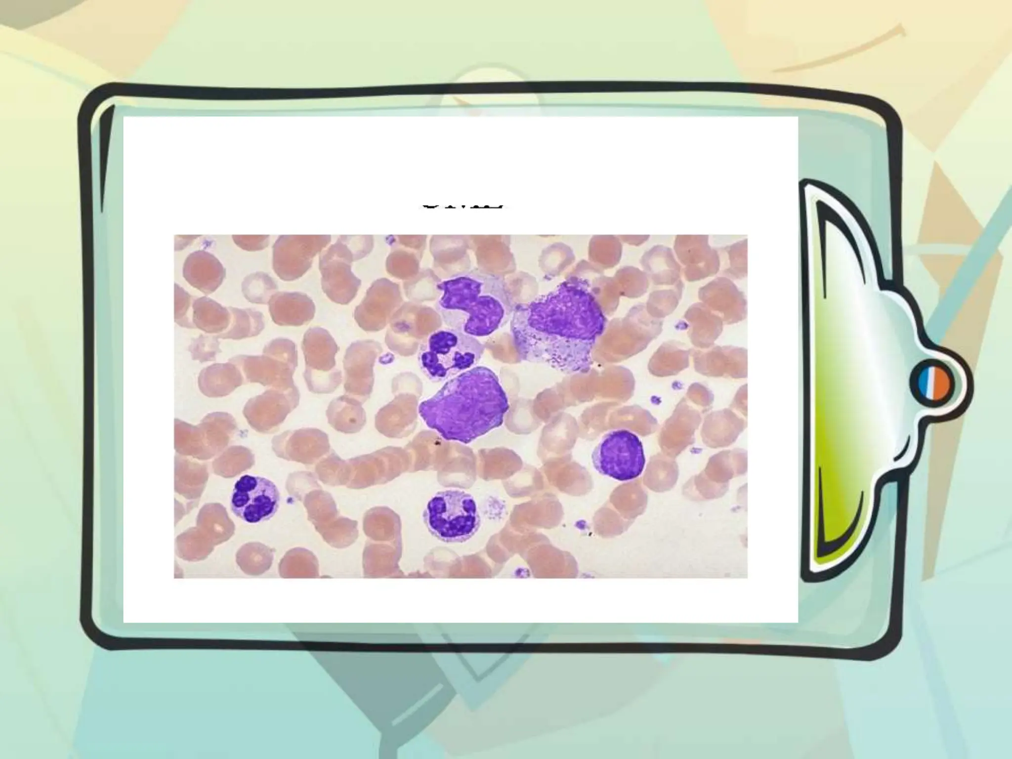 Interpretation of the peripheral smear and CBC | PPT