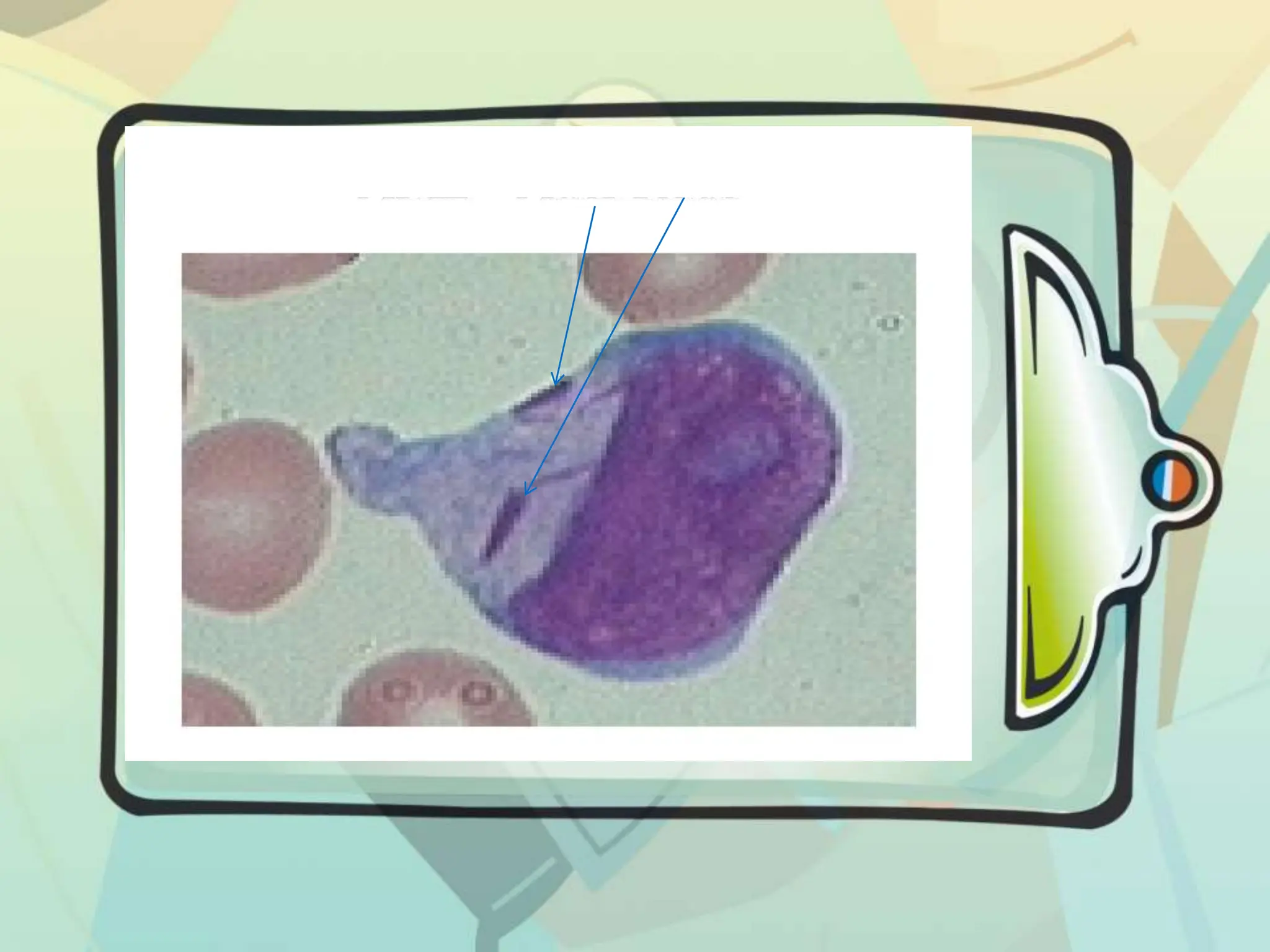 Interpretation of the peripheral smear and CBC | PPT