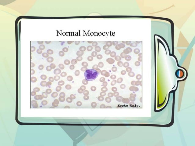 Interpretation of the peripheral smear and CBC | PPT