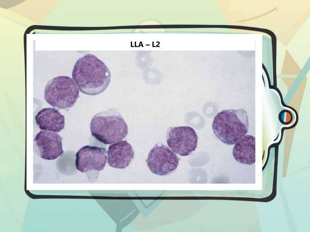 Interpretation of the peripheral smear and CBC | PPT