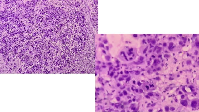 Frozen section i pathology pptc for Post graduate | PPTX