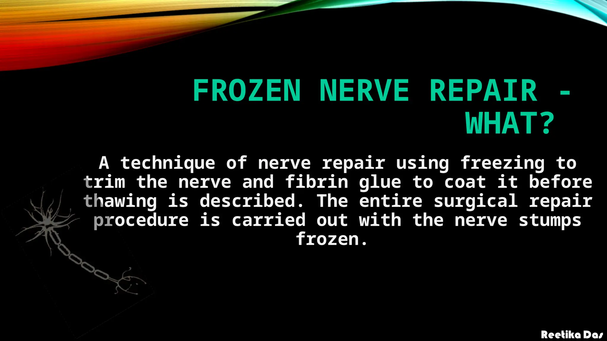 FROZEN NERVE REPAIR.pptx A technique of nerve repair using freezing to ...