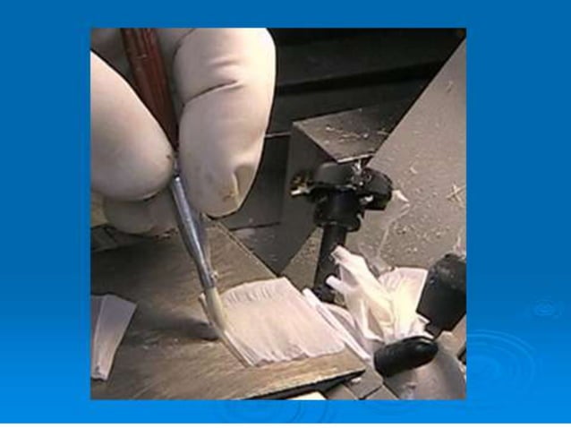 Frozen section and cryostat | PPTX