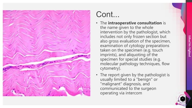 Frozen section & cryostat | PPT