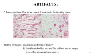 FROZEN SECTION FINAL HISTOPATHOLOGY.pptx