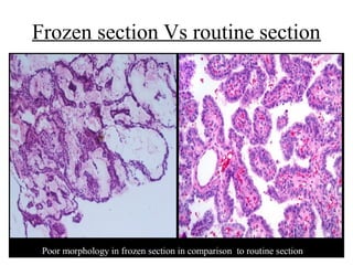 FROZEN SECTION ppt in which method is described in detail | PPTX