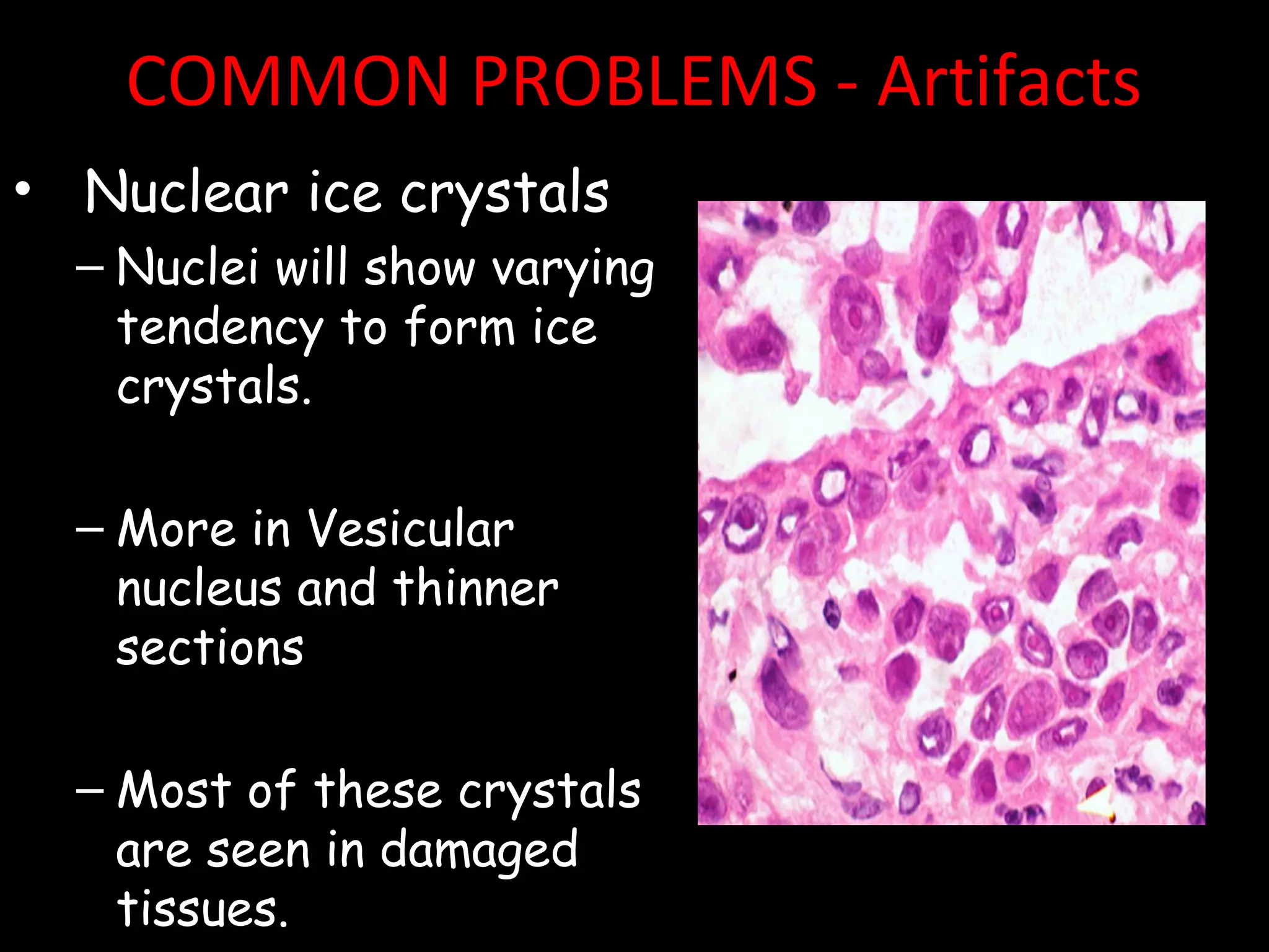 Frozen section overview and application | PPT