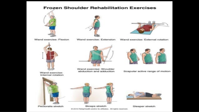 Frozen shoulder