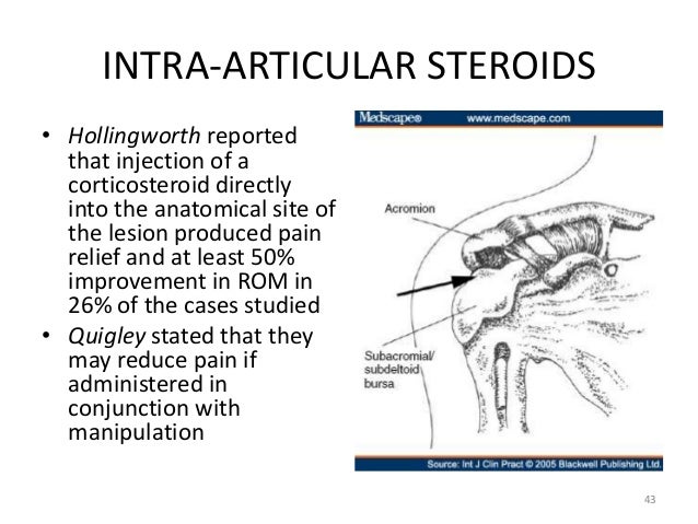 Frozen shoulder 9.6.15