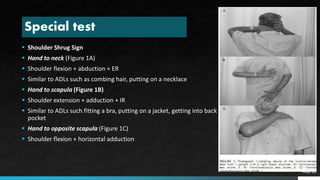 Frozen shoulder BY MIN^ED ACADEMY | PPTX