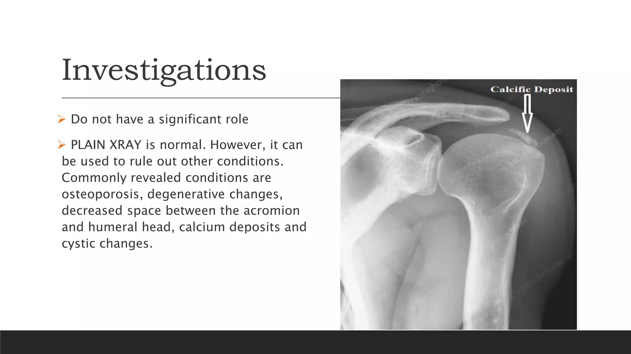 FROZEN SHOULDER ppt.pptx