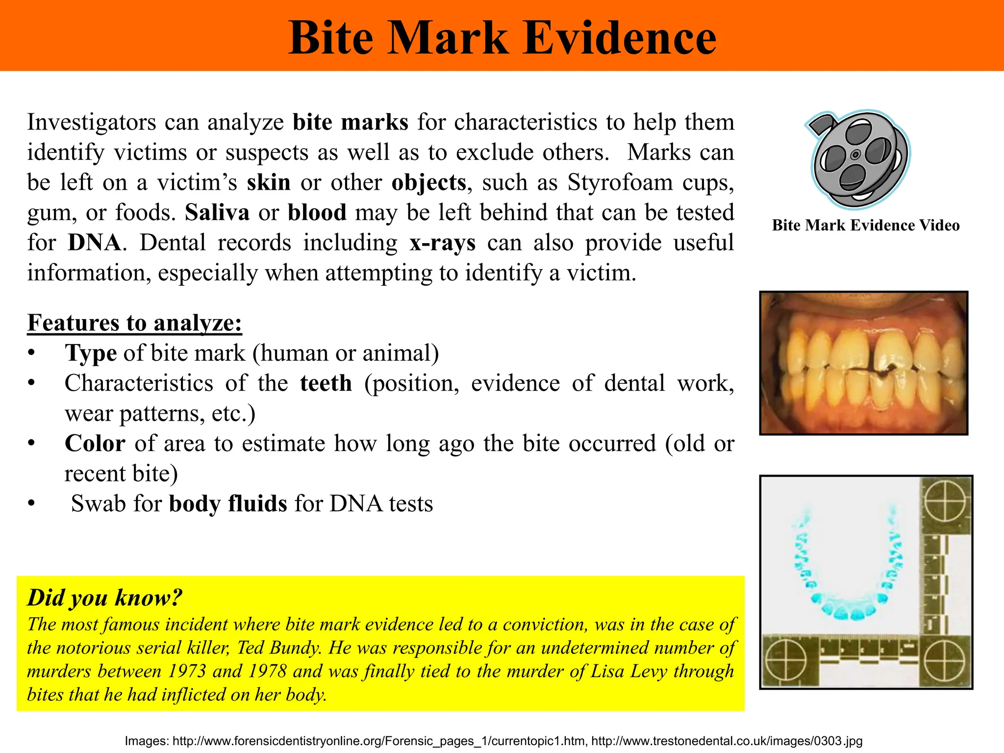 FRS 310 Bite mark evidence.ppt