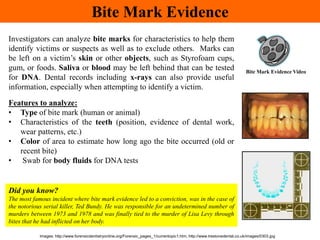 FRS 310 Bite mark evidence.ppt