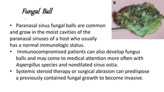 fungal rhinosinusitis | PPT