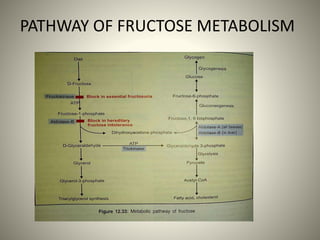 Fructose Metabolism In Liver | PPTX