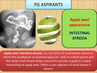 Fruit signs to remember related to diseases | PPT