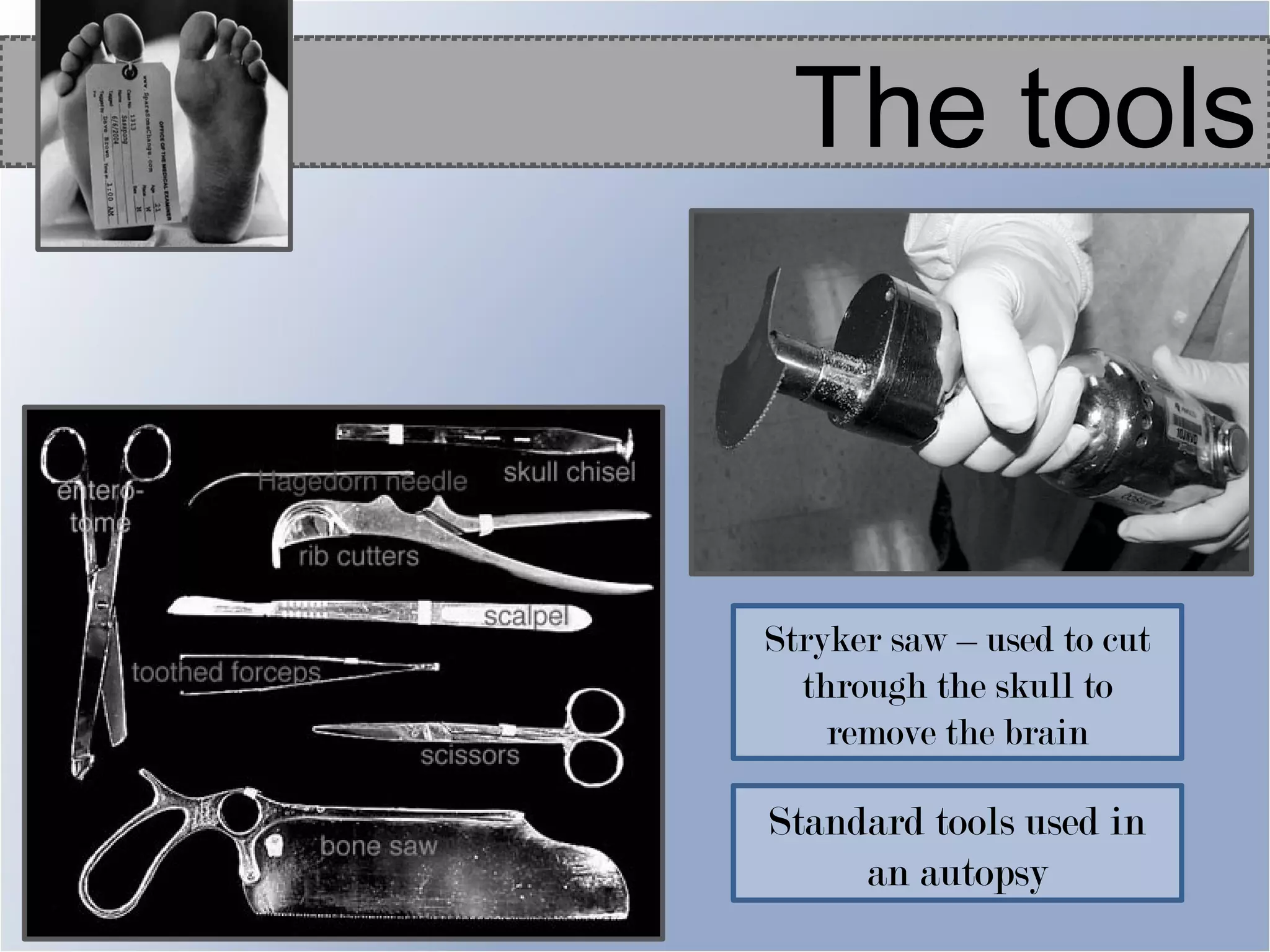 Chapter 13 - Process of Death | PPT