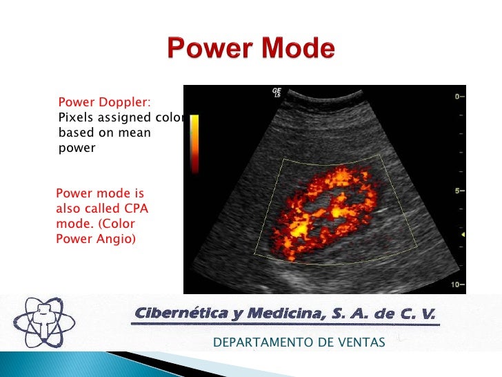 Física básica del ultrasonido