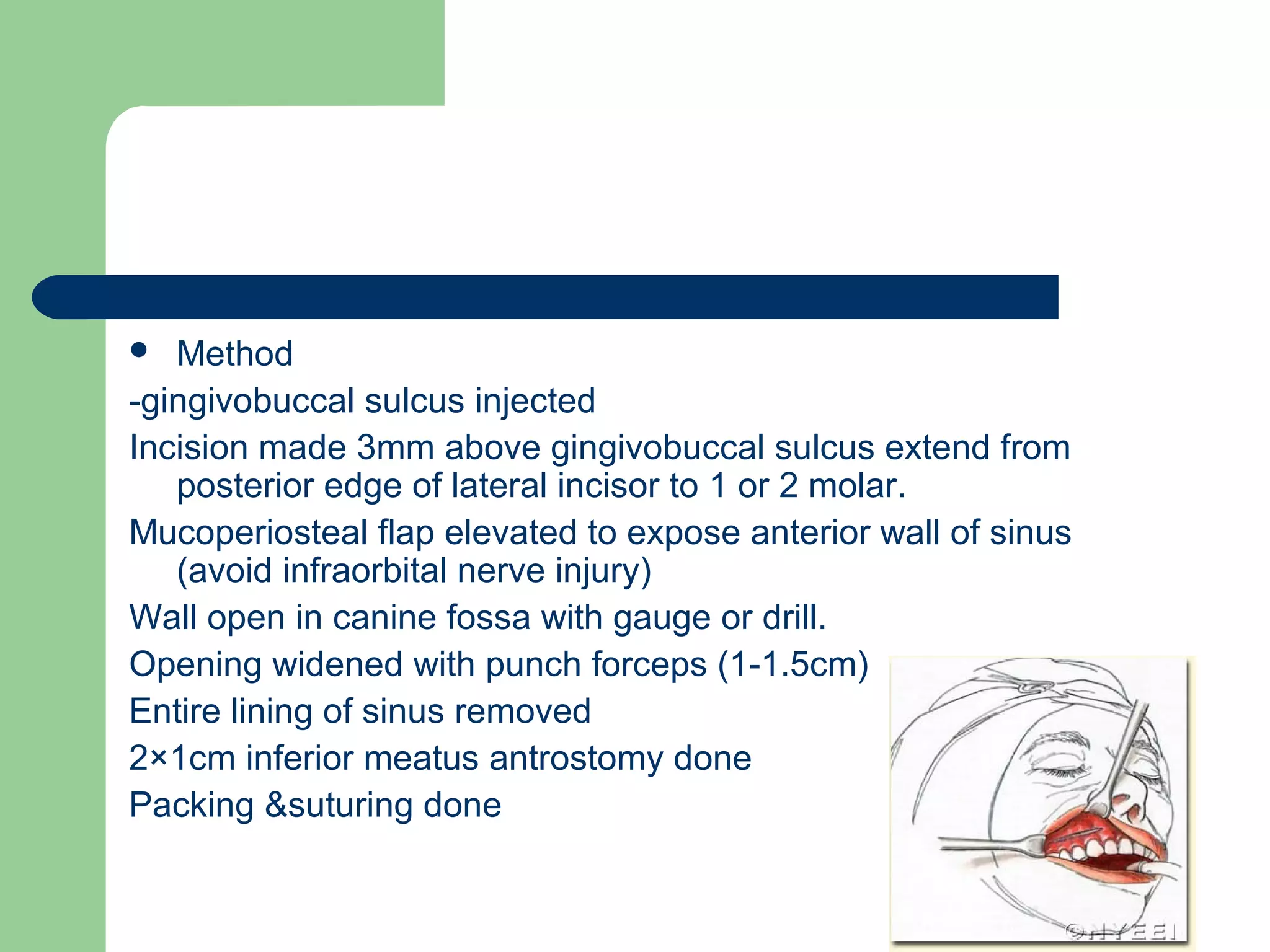 surgical management of sinusitis | PPT