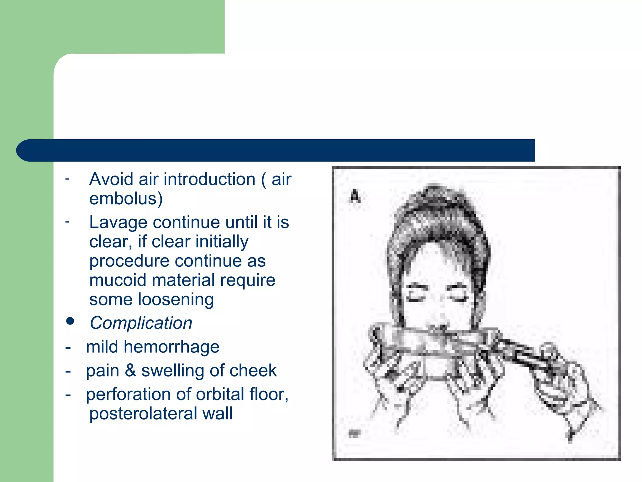 surgical management of sinusitis | PPT