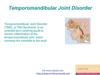 Temporomandibular Joint Disorder | PPT